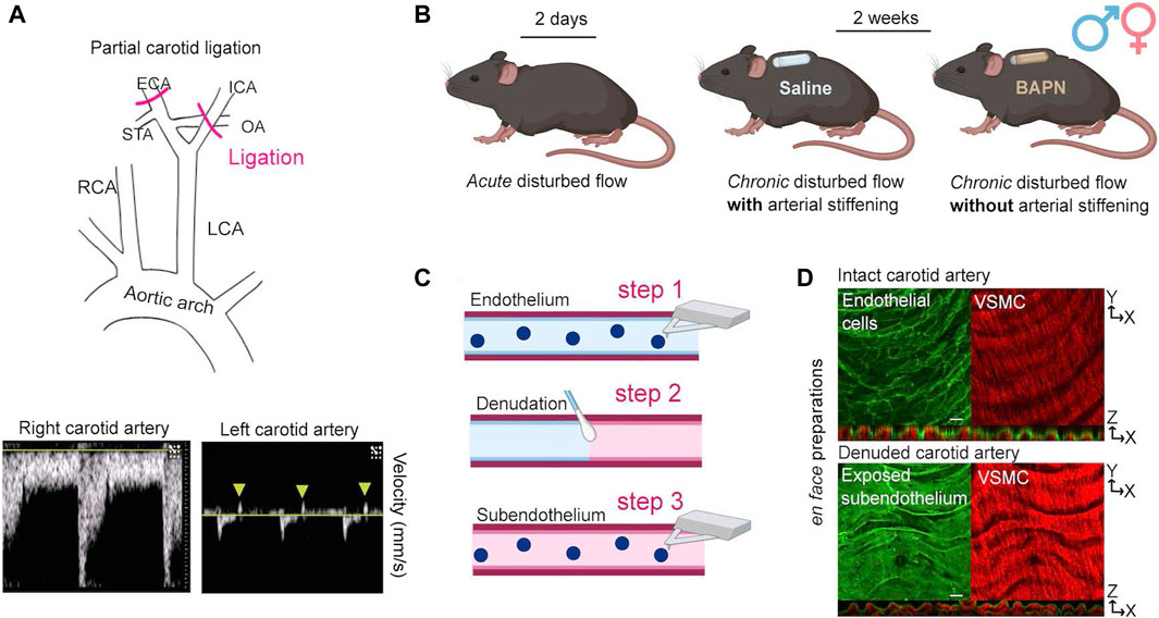 SEBM | Modulation of arterial intima stiffness by disturbed blood flow