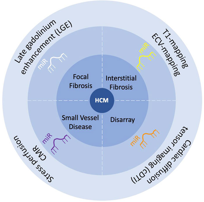 SEBM | Circulating microRNA as promising biomarkers in hypertrophic ...