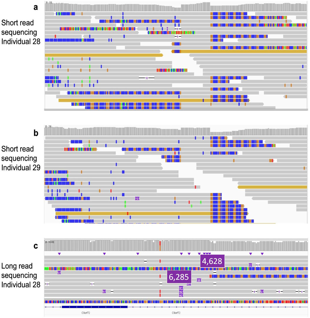 SEBM | Comprehensive identification of pathogenic tandem repeat ...